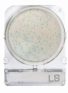 Compact Dry: Placas Cromogénicas para Detección de Microorganismos